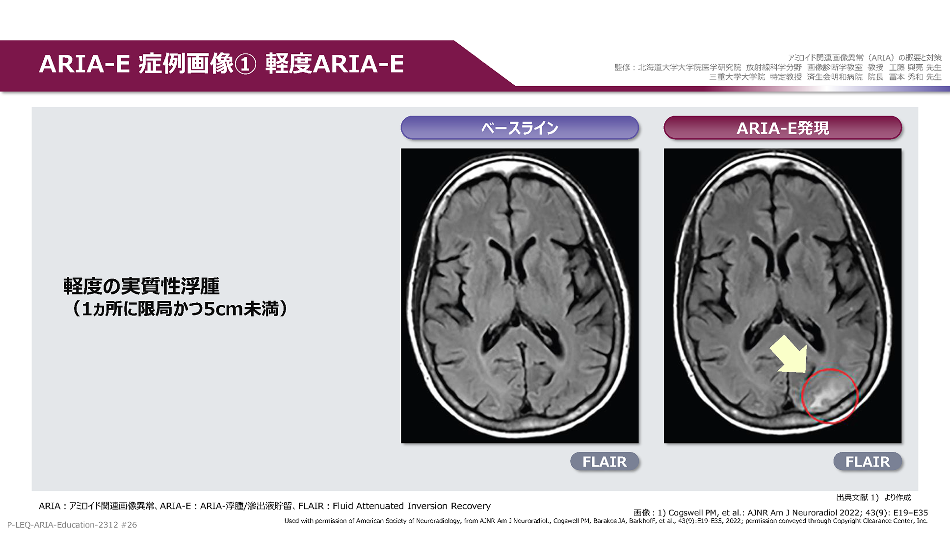 ARIA e-learning | レケンビ | エーザイ Medical.eisai.jp 医療関係者向けサイト