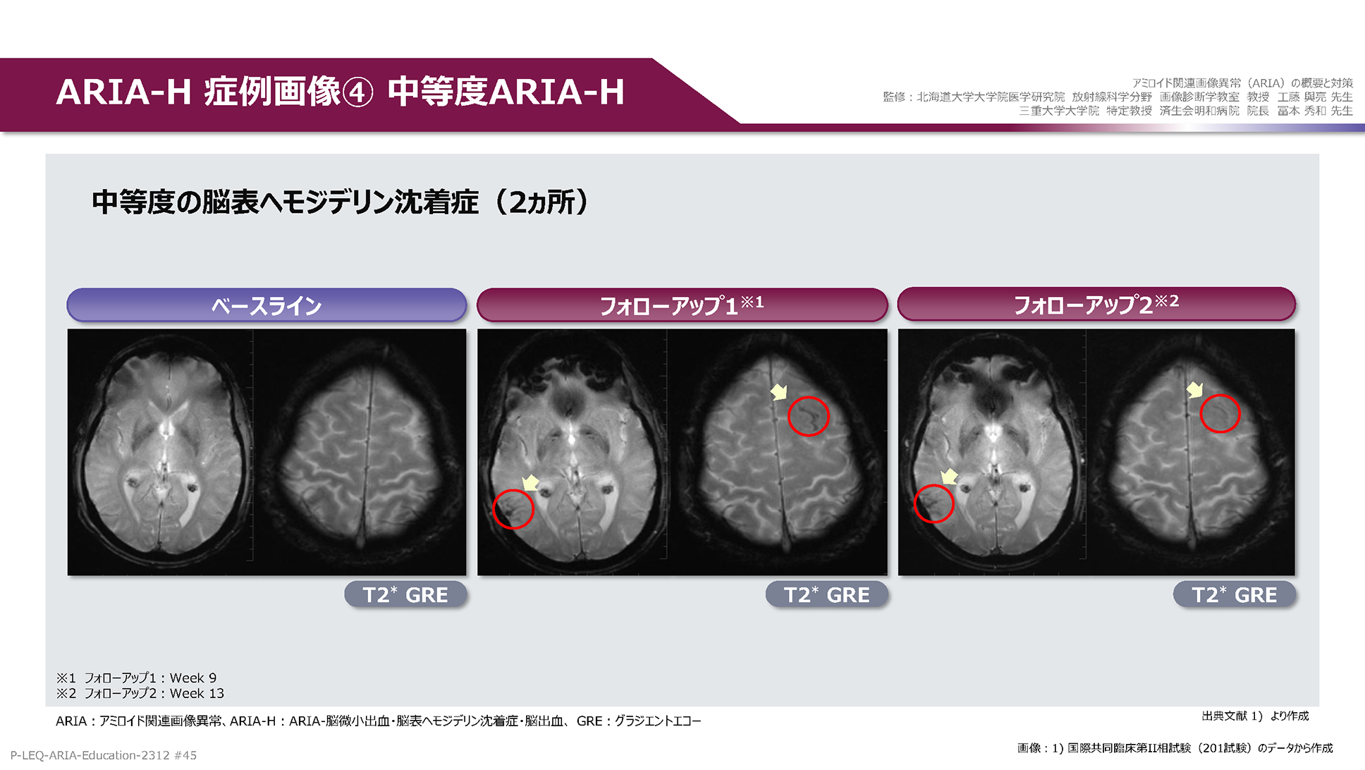 ARIA e-learning | レケンビ | エーザイ Medical.eisai.jp 医療関係者向けサイト