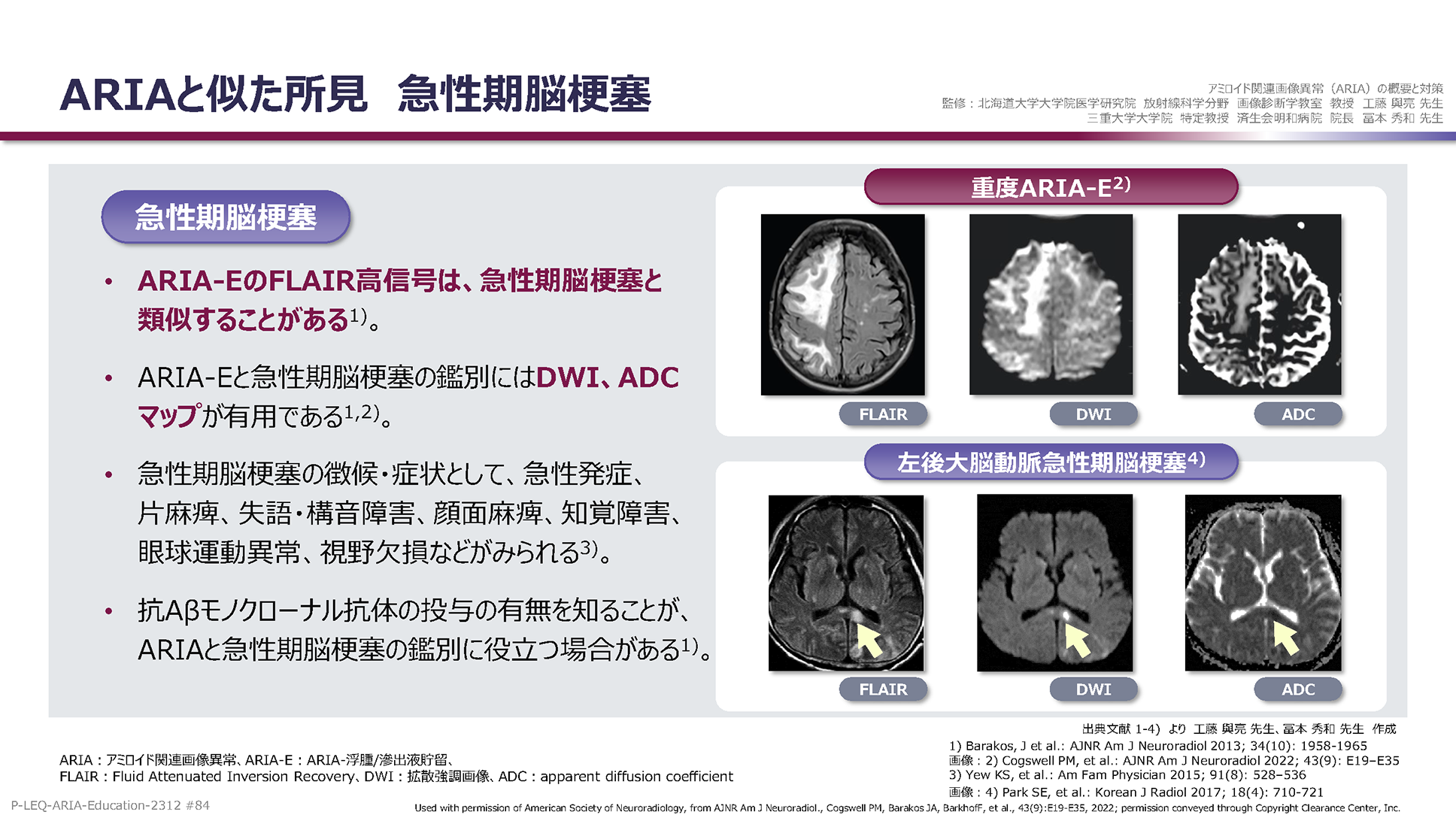 ARIA e-learning | レケンビ | エーザイ Medical.eisai.jp 医療関係者向けサイト